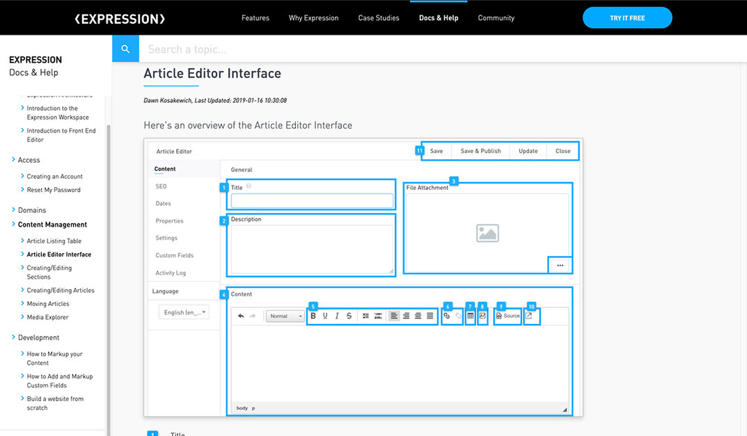 The Article Editor Allow Admin Users To Easily Edit Content | Expression